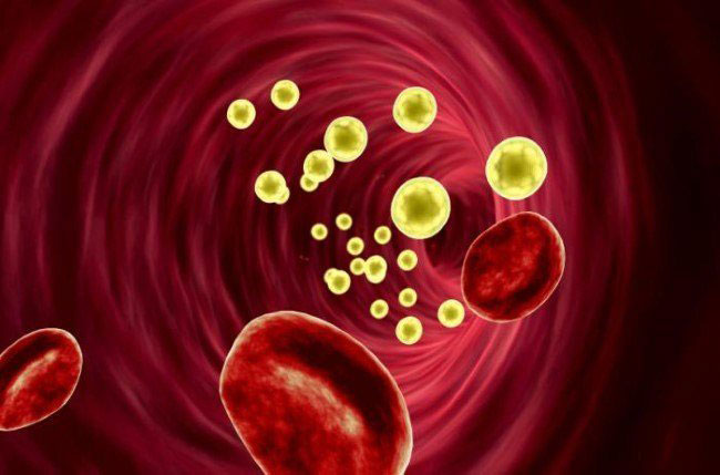 Hipertrigliceridemia, una herencia familiar que aumenta la grasa en ...
